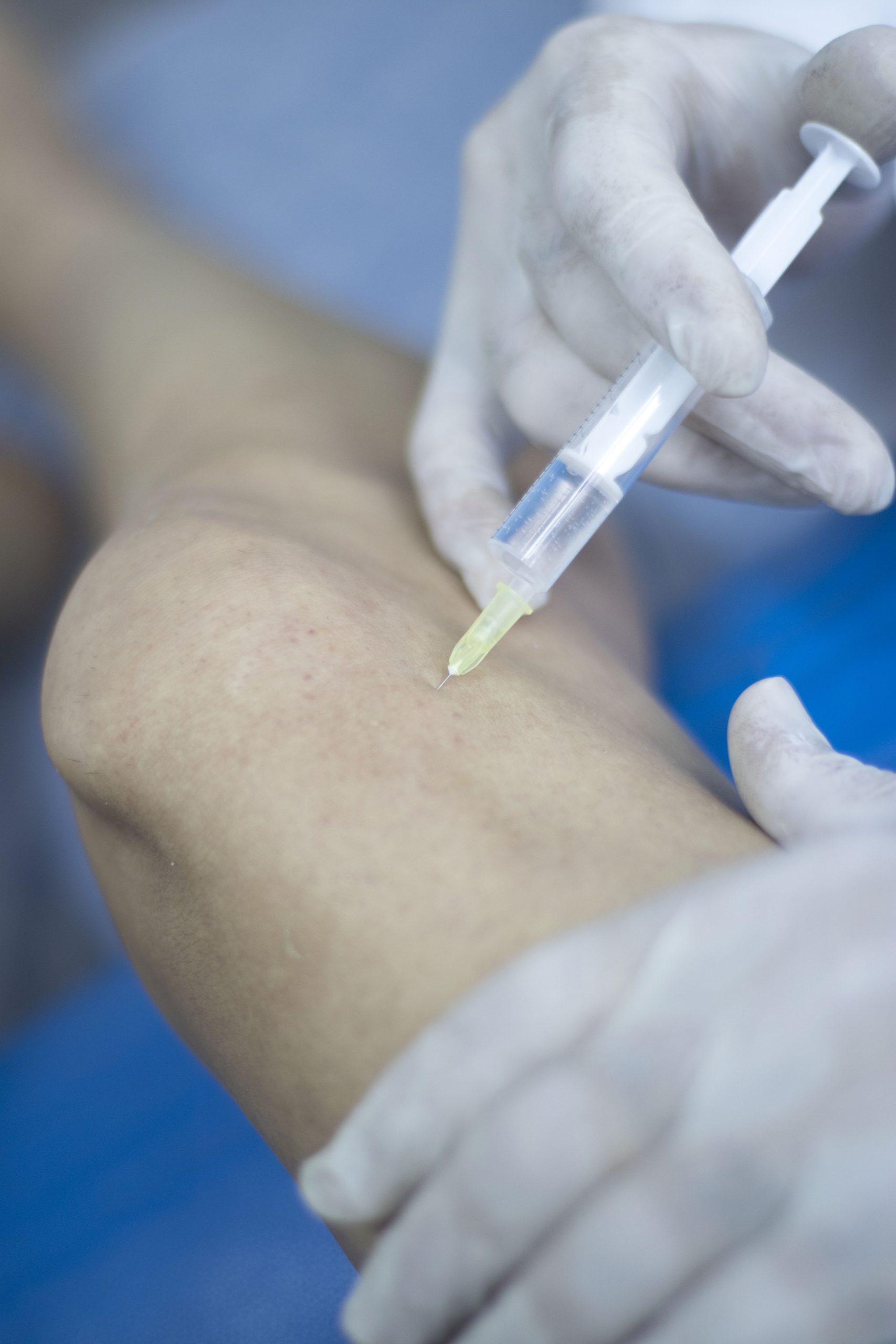 Infiltración de corticoides - Kinelite